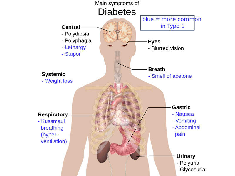 Ozempic semaglutide For The Treatment Of Type 2 Diabetes Clinical Ozempic semaglutide For The Treatment Of Type 2 Diabetes Clinical