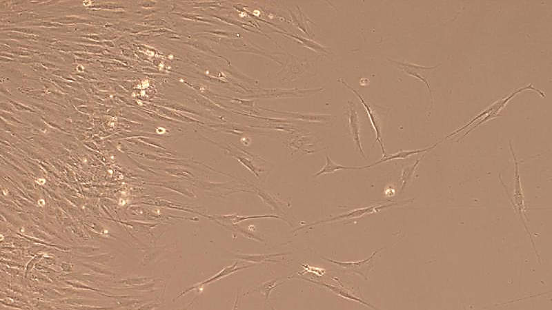 Human Primary Cell Cultures and Cell Lines - Clinical Trials Arena