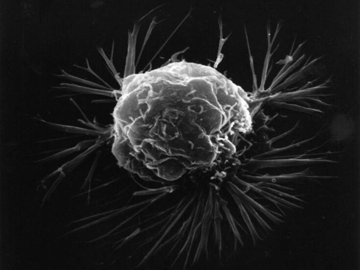 Daiichi Sankyo-AstraZeneca’s trastuzumab deruxtecan clears Phase II trial