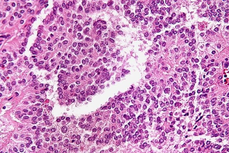 Replimune launches Phase I trial of RP2 in cancer patients