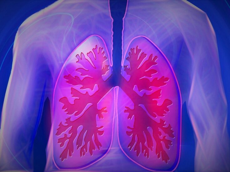 Pfizer reports positive data from lung cancer drug trial
