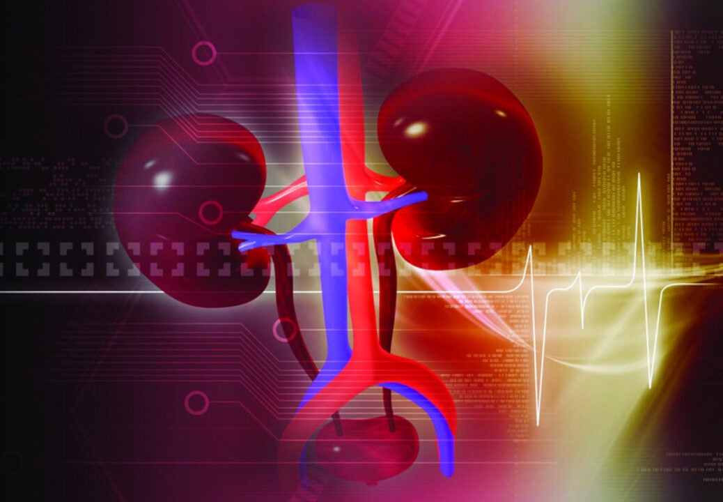 Dicerna’s nedosiran may be used in non-responders to Alnylam’s Oxlumo