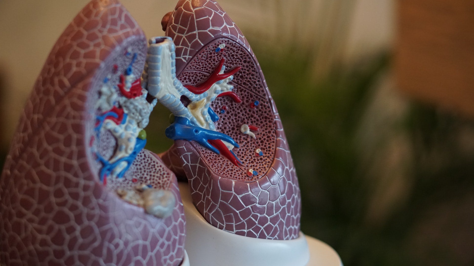 AnHeart Therapeutics begins dosing in Phase II lung cancer therapy trial