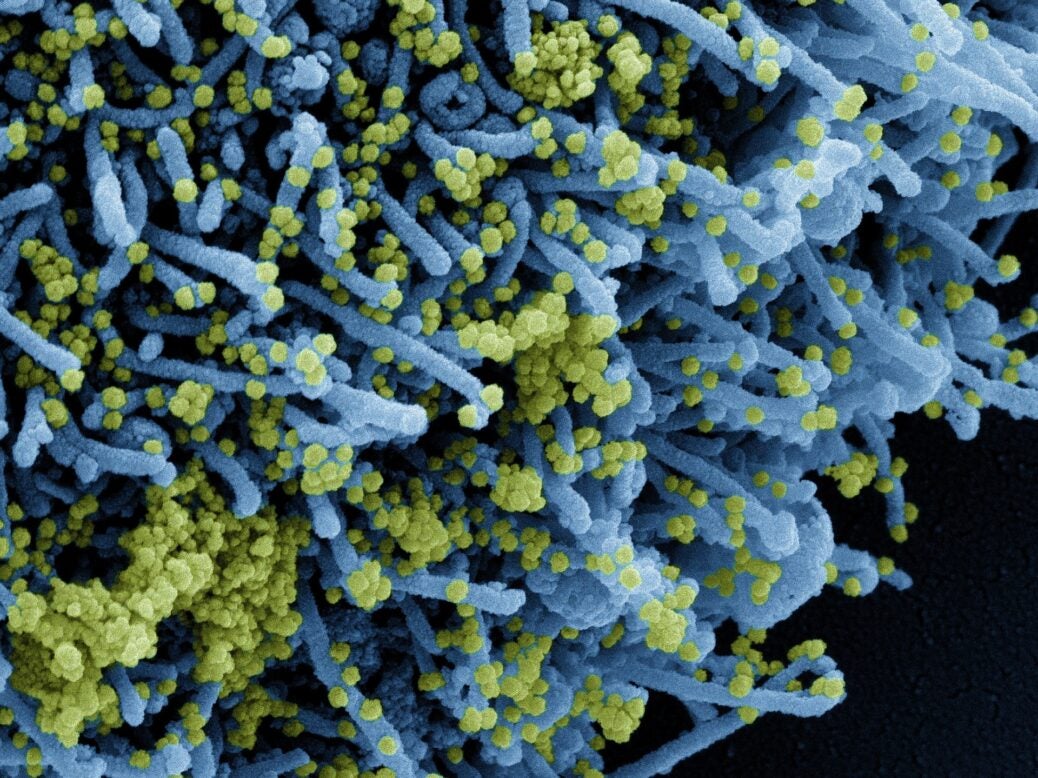AB Science begins dosing in Phase II Covid-19 trial
