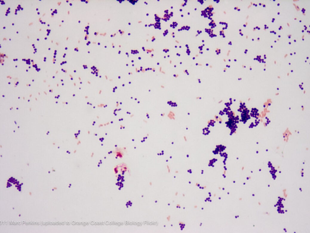 Recce gets safety committee advice for Phase I RECCE 327 trial progress