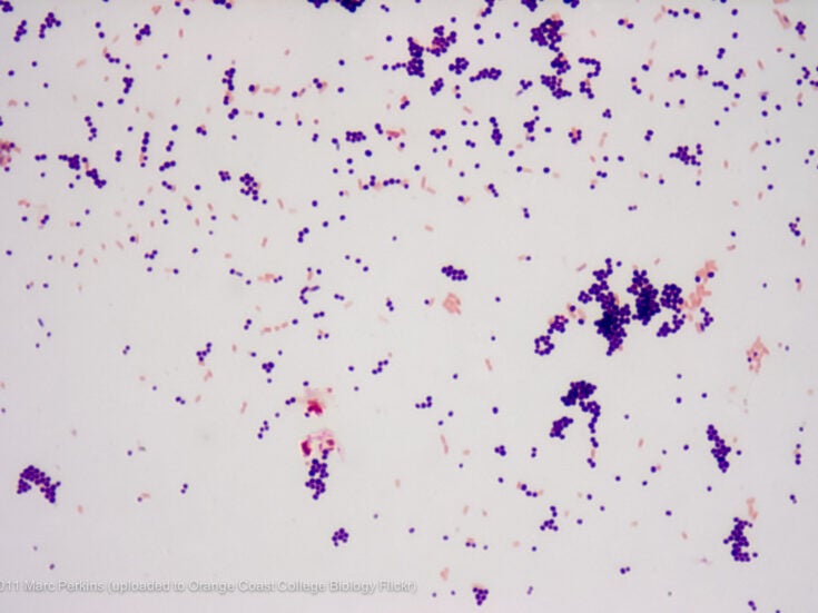 HDT Bio and Gennova dose healthy subjects in Covid-19 trial in India