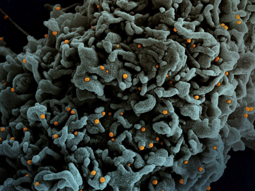 BMS’ deucravacitinib shows superiority in Phase III psoriasis trial