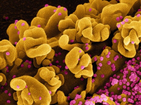 BerGenBio randomises first patient in Covid-19 treatment study