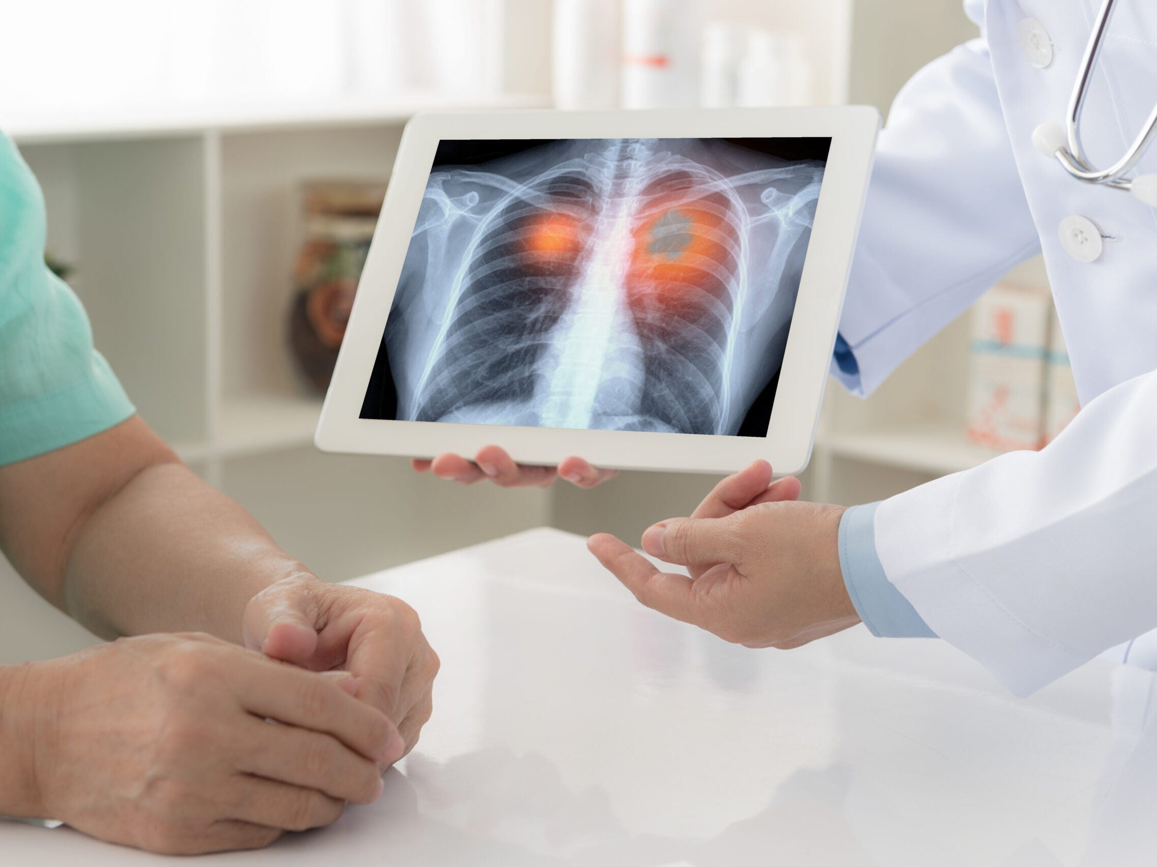 Vergent Bioscience shares Phase IIb plans for oncology imaging agent