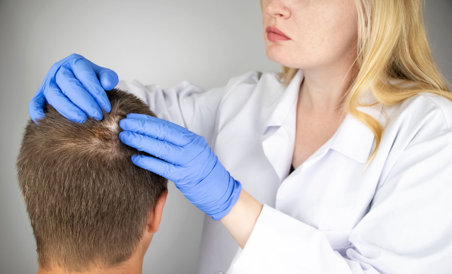 Technoderma reports data from androgenetic alopecia drug trial