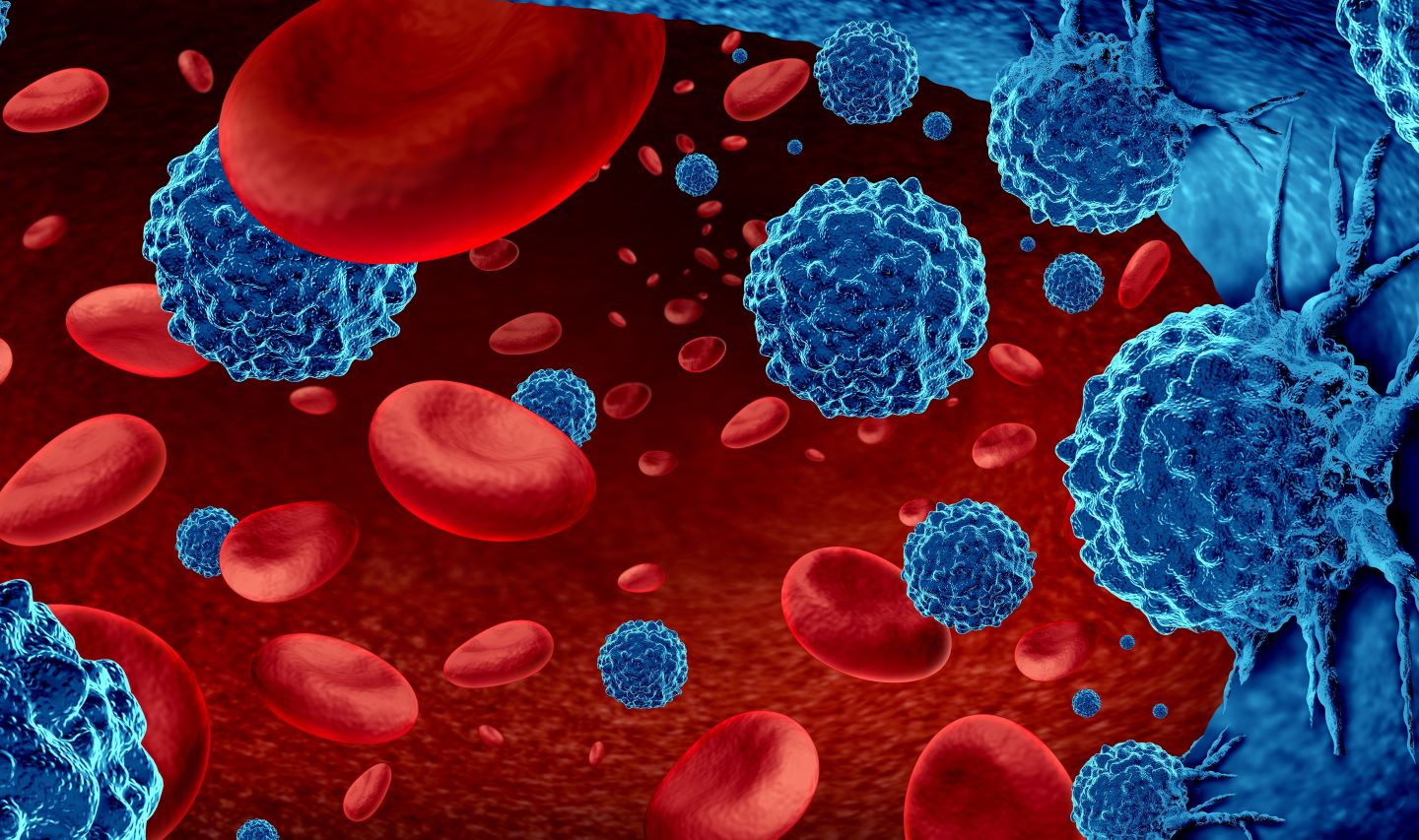 Arovella Therapeutics to raise funds for trial of lymphoma drug