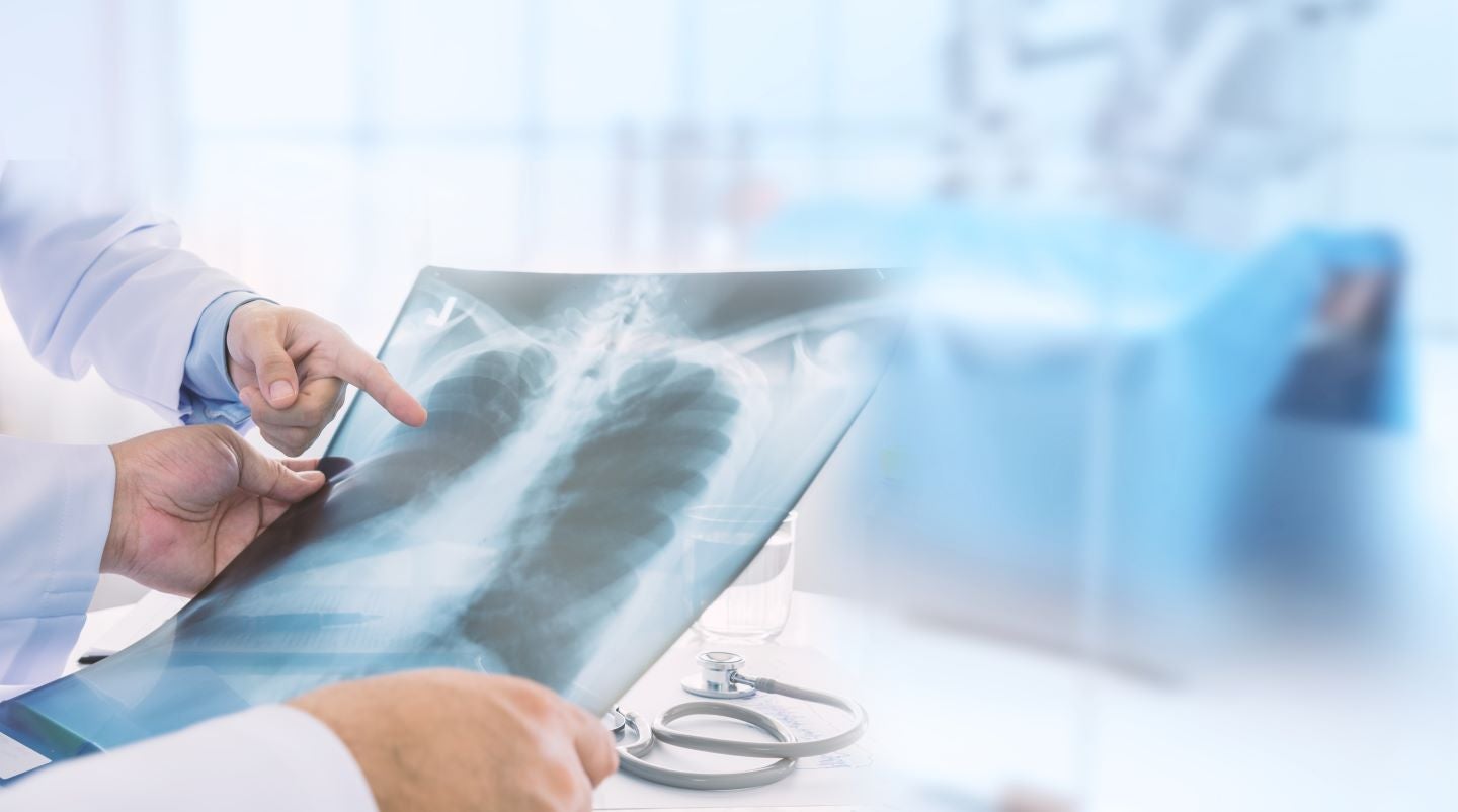 Kiromic activates new clinical site for Phase I NSCLC treatment trial