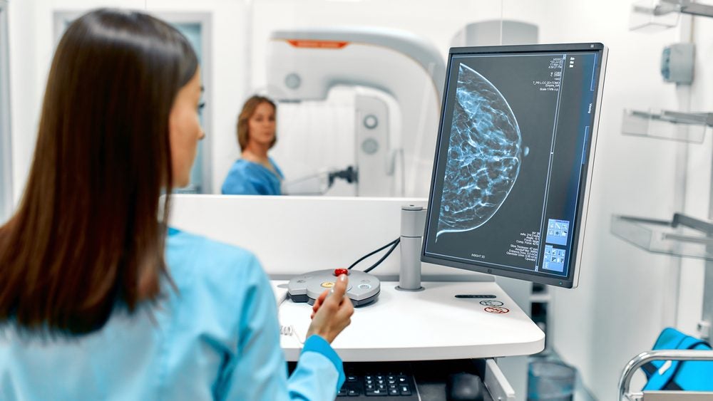 QT imaging’s breast imaging system proves as effective as mammography ...