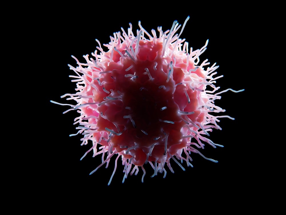 Sanofi advances NK cell engager to Phase II for blood cancer treatment ...