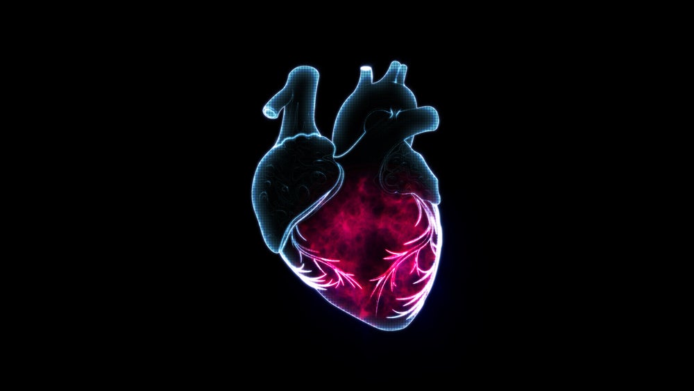 FIRE1 implants first patient with vessel sensor in Ireland - Clinical ...