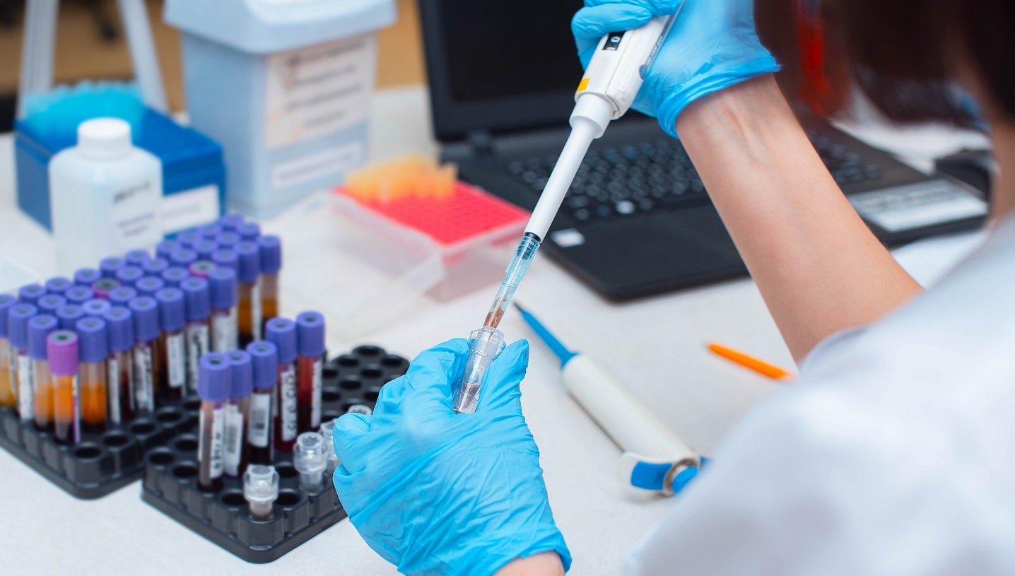 Rznomics to commence RNA editing therapy trial for retinitis pigmentosa