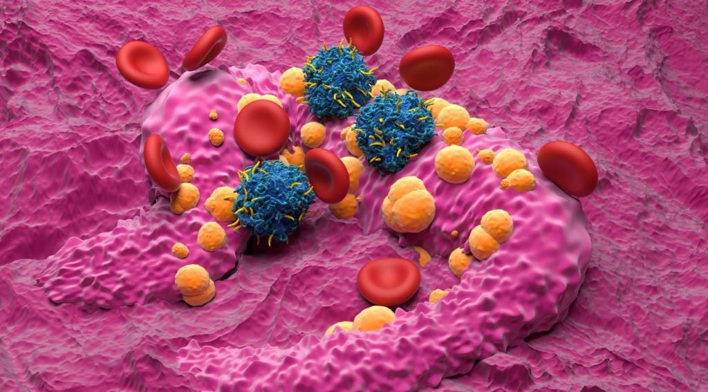 BMS’ deucravacitinib shows superiority in Phase III psoriasis trial