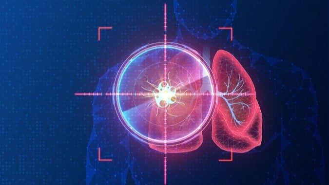 Alpha Tau looks to target multiple indications for Alpha DaRT radiotherapy