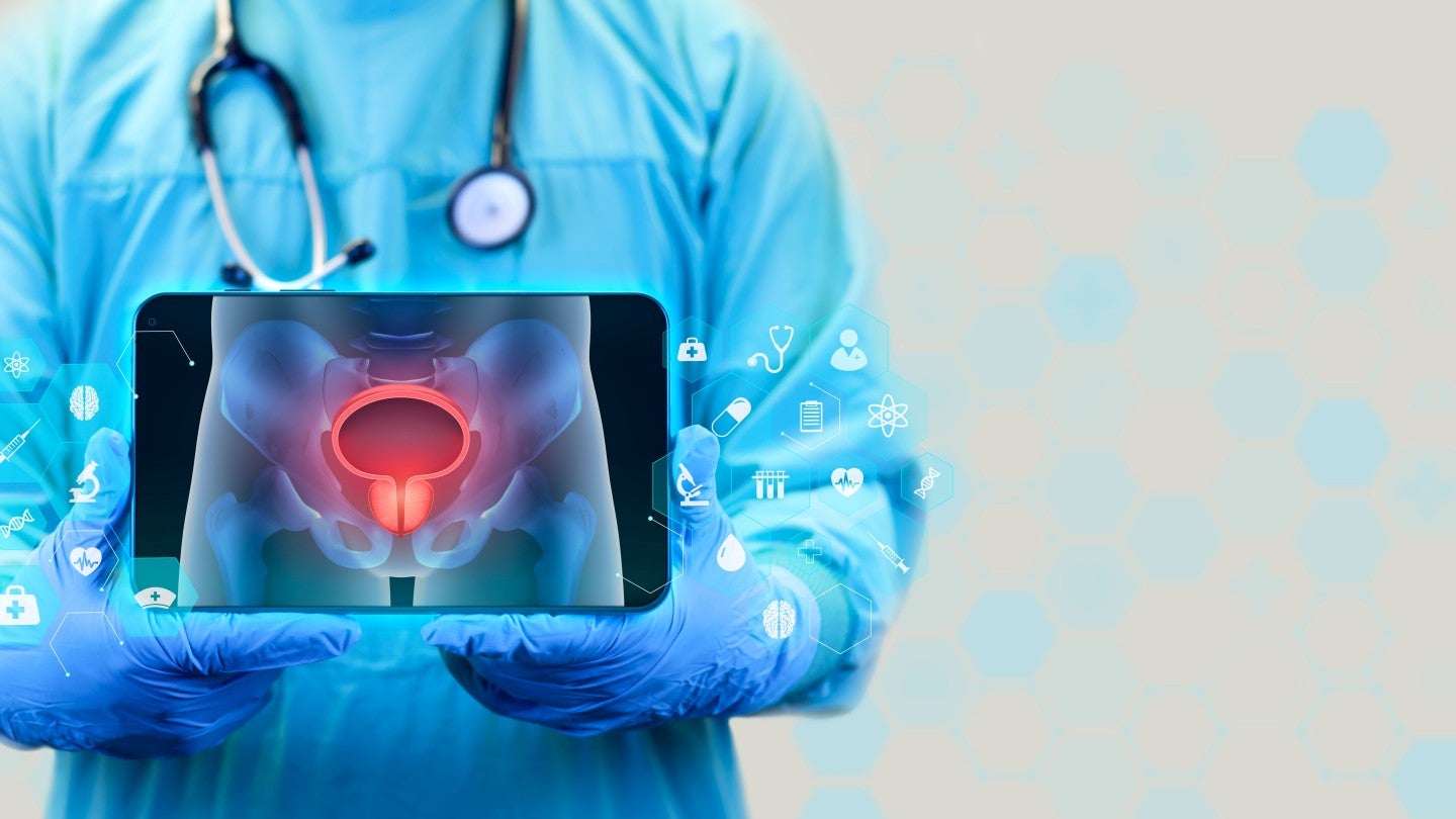 UroGen begins subject dosing in Phase III bladder cancer drug trial