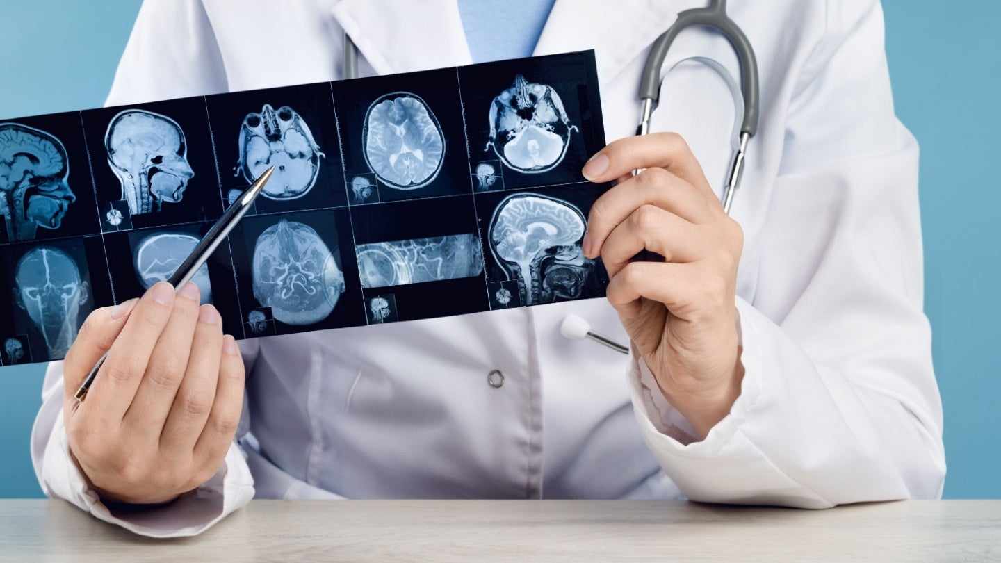 Sudo Biosciences trialling drug for neuroinflammatory diseases