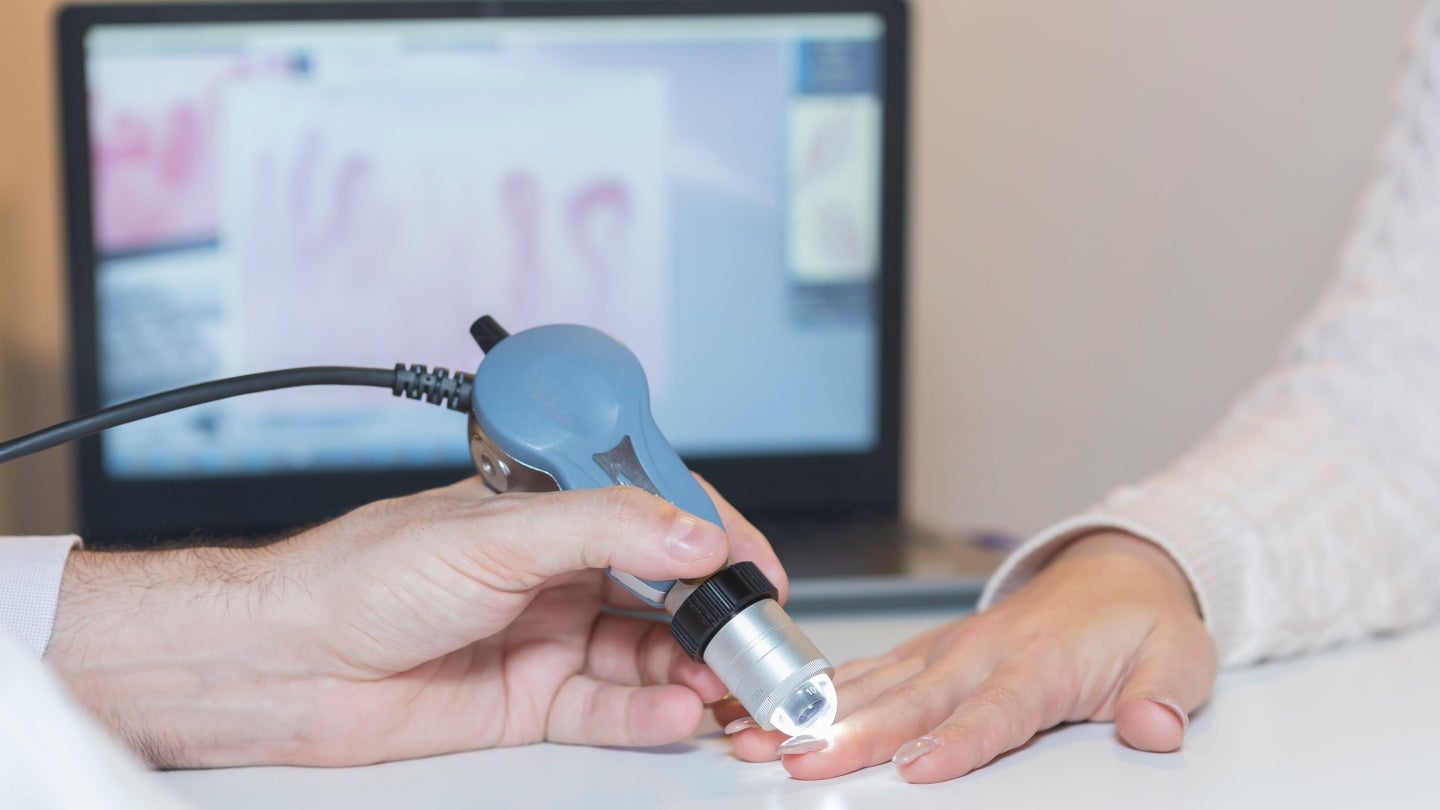 Zura Bio initiates Phase II systemic sclerosis treatment trial