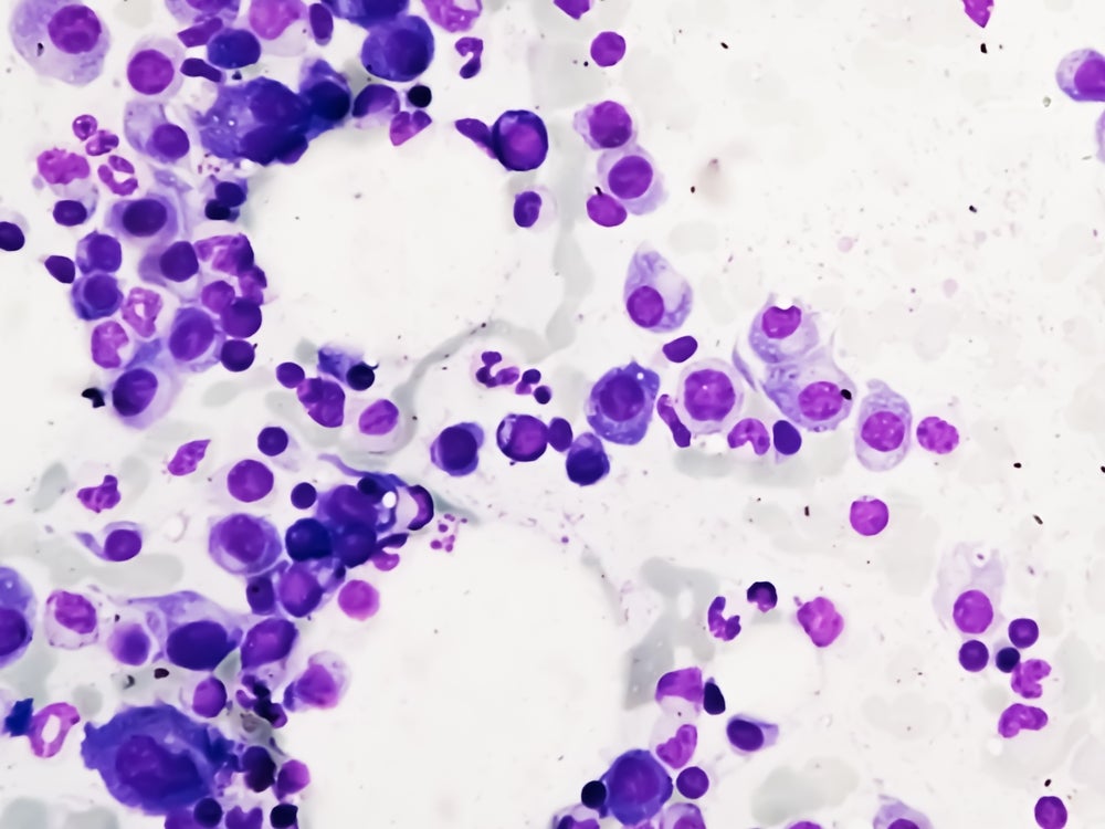 C4’s multiple myeloma drug to reach pivotal trials after Phase I ...